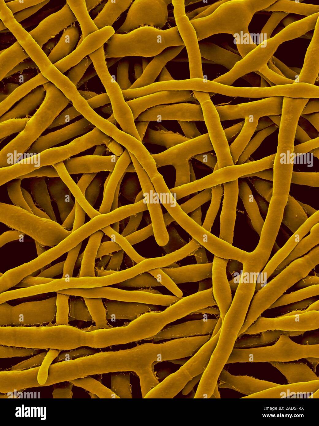 Coloured scanning electron micrograph (SEM) of Filamentous allergenic ...