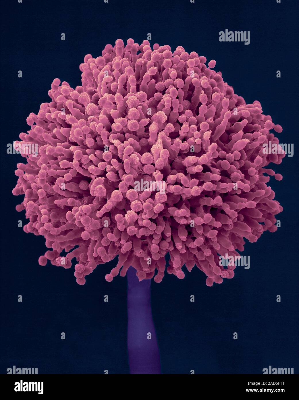 Coloured scanning electron micrograph (SEM) of Green mould (Aspergillus flavus) - conidiophore ...