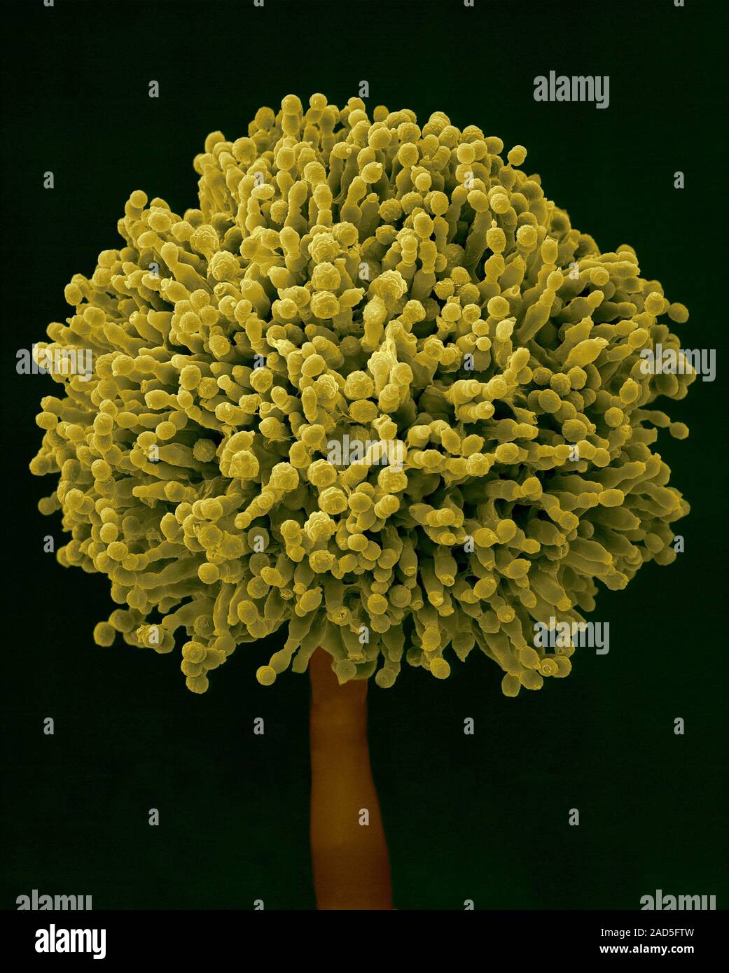 Coloured scanning electron micrograph (SEM) of Green mould (Aspergillus ...