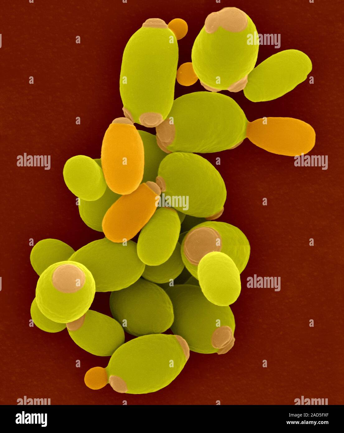 Coloured scanning electron micrograph (SEM) of Candida yeast (Candida ...