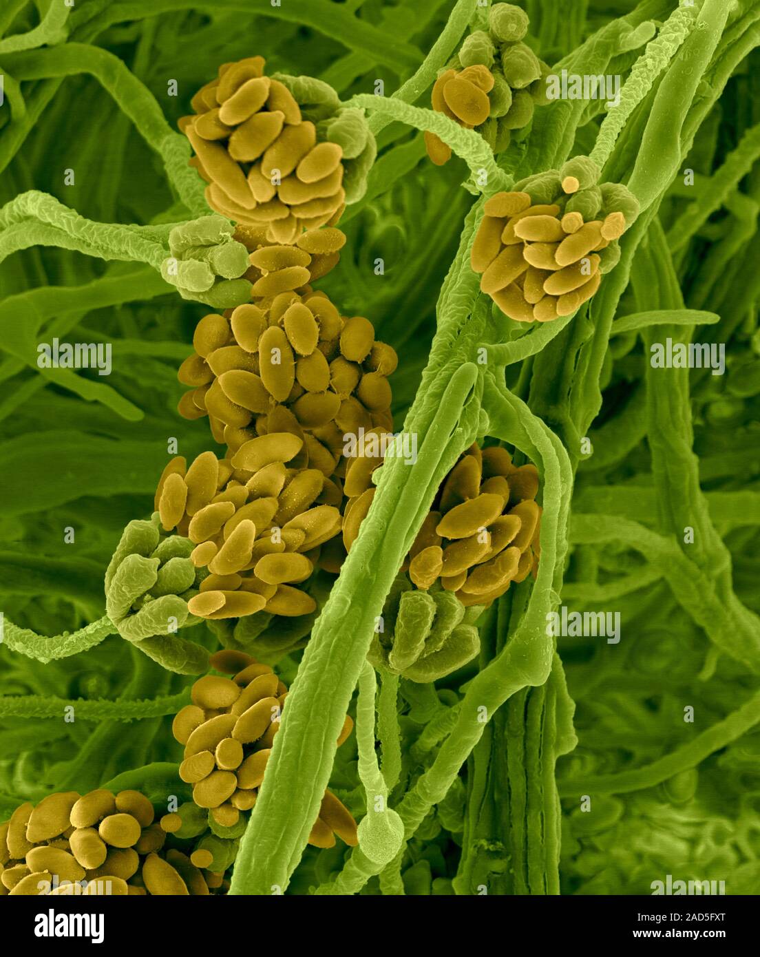Coloured scanning electron micrograph (SEM) of Stachybotrys chartarum ...