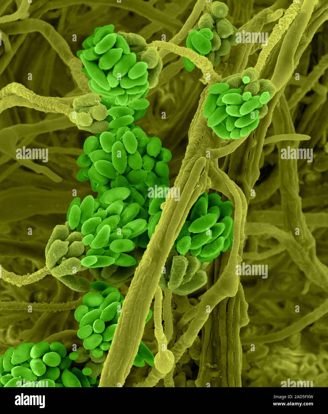 Coloured scanning electron micrograph (SEM) of Stachybotrys chartarum ...