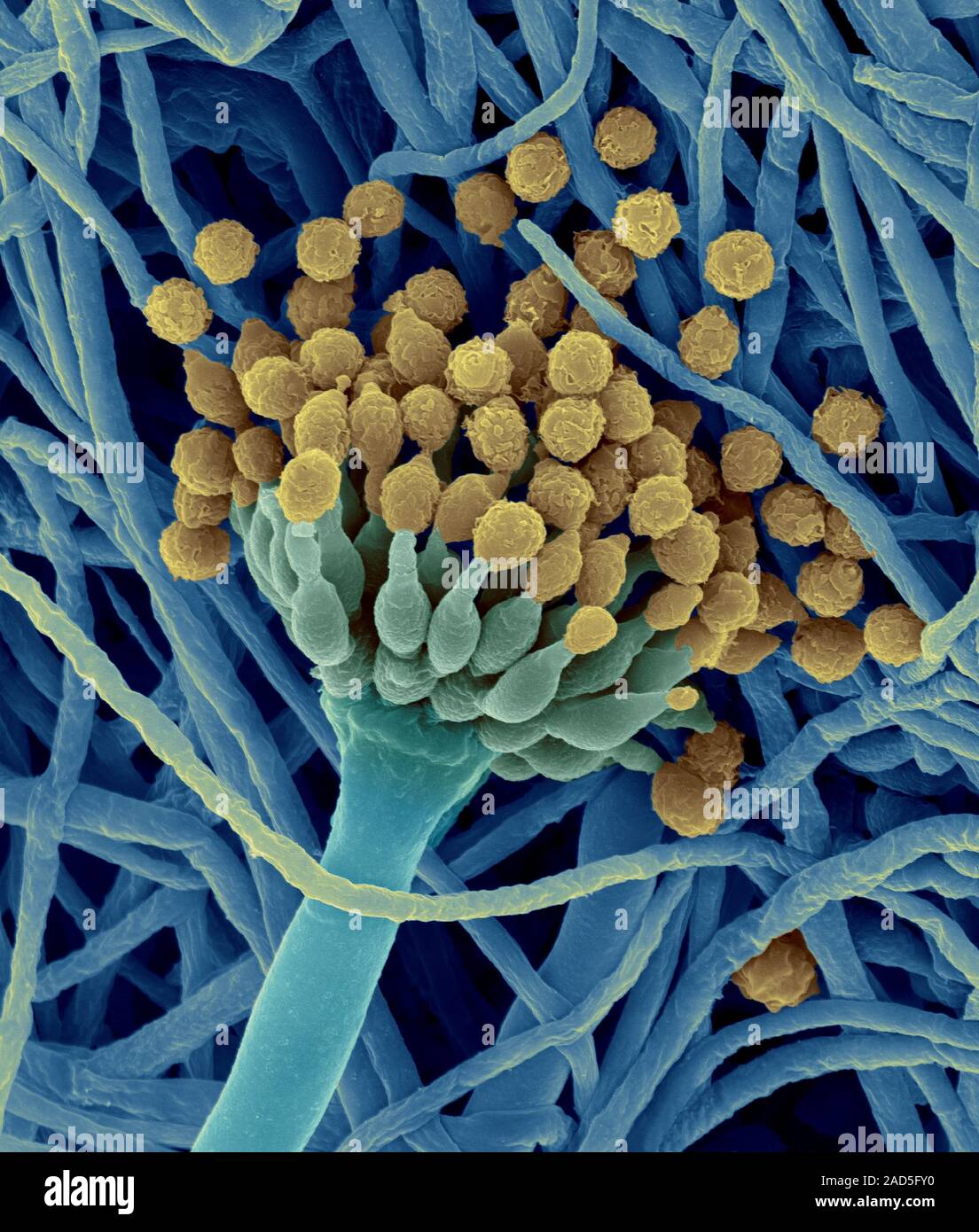 Coloured scanning electron micrograph (SEM) of Green mould hyphae and fruiting structure ...