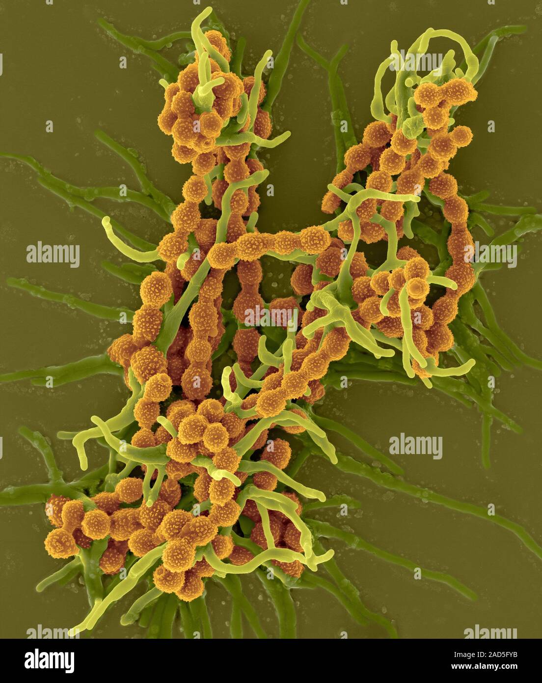 Coloured scanning electron micrograph (SEM) of Hyphae and conidia ...