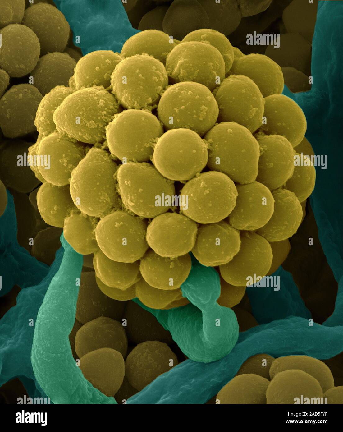 Coloured scanning electron micrograph (SEM) of Soil fungus condiophore ...