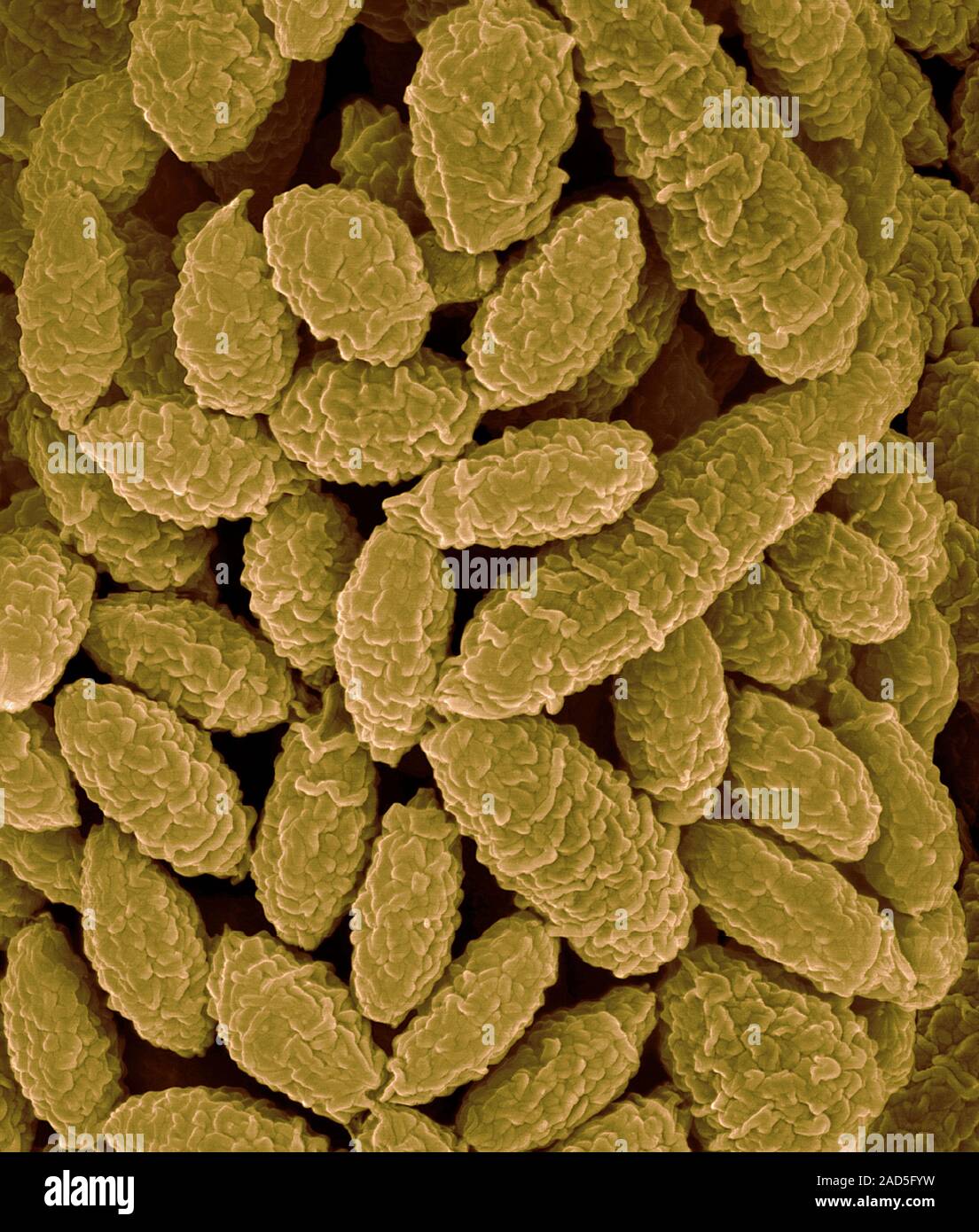 Coloured scanning electron micrograph (SEM) of Paecilomyces variotii ...
