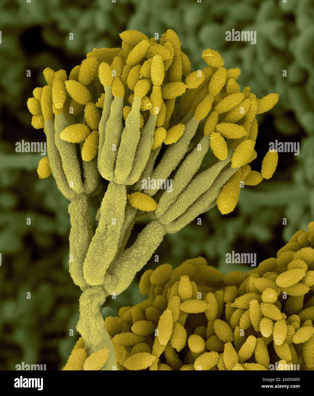 Coloured scanning electron micrograph (SEM) of Paecilomyces variotii ...
