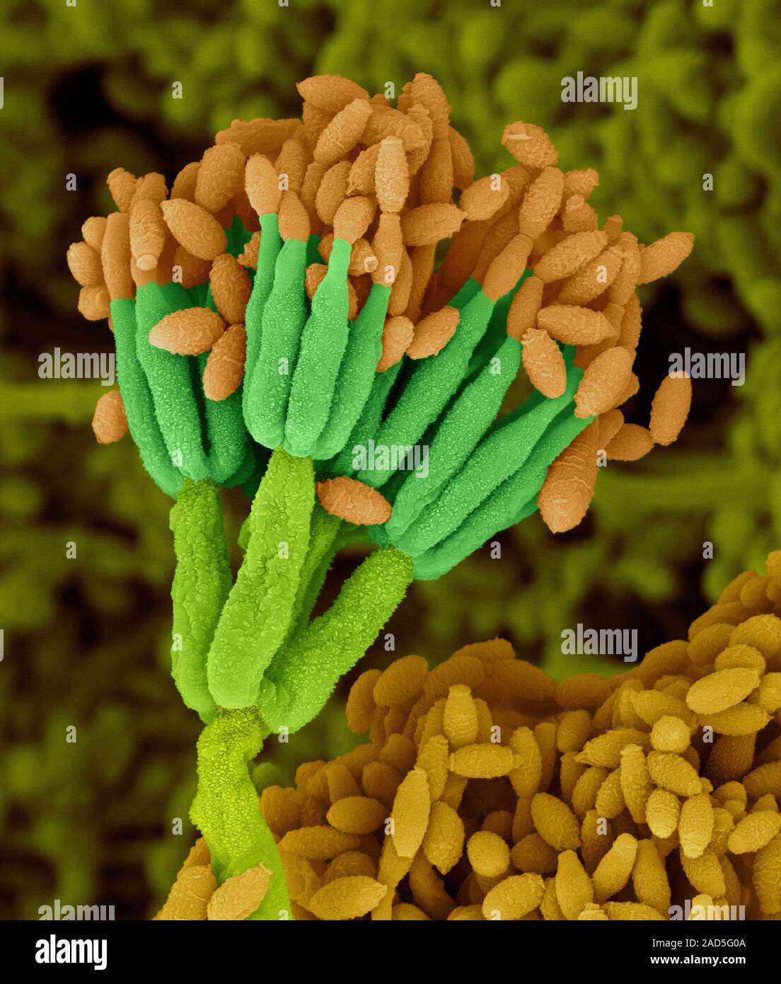 Coloured scanning electron micrograph (SEM) of Paecilomyces variotii fruiting body and ascospore ...