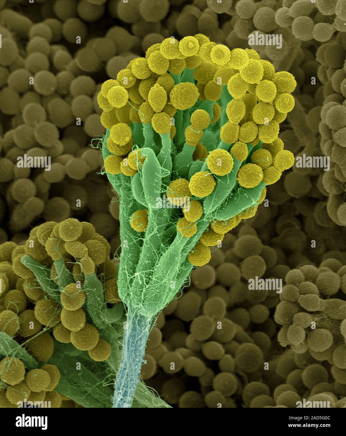 Coloured scanning electron micrograph (SEM) of Mould conidiophores ...