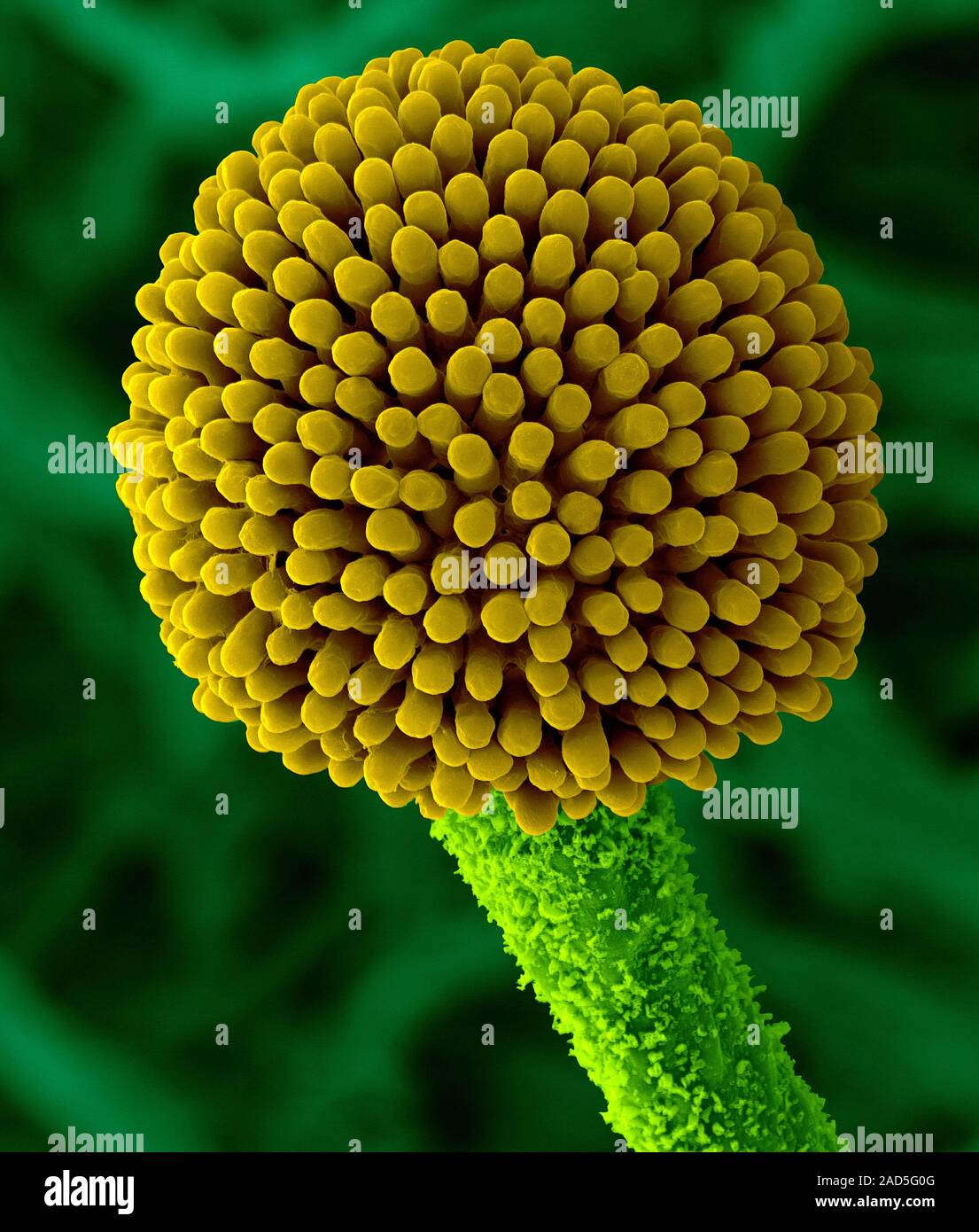 Coloured scanning electron micrograph (SEM) of Developing mould ...