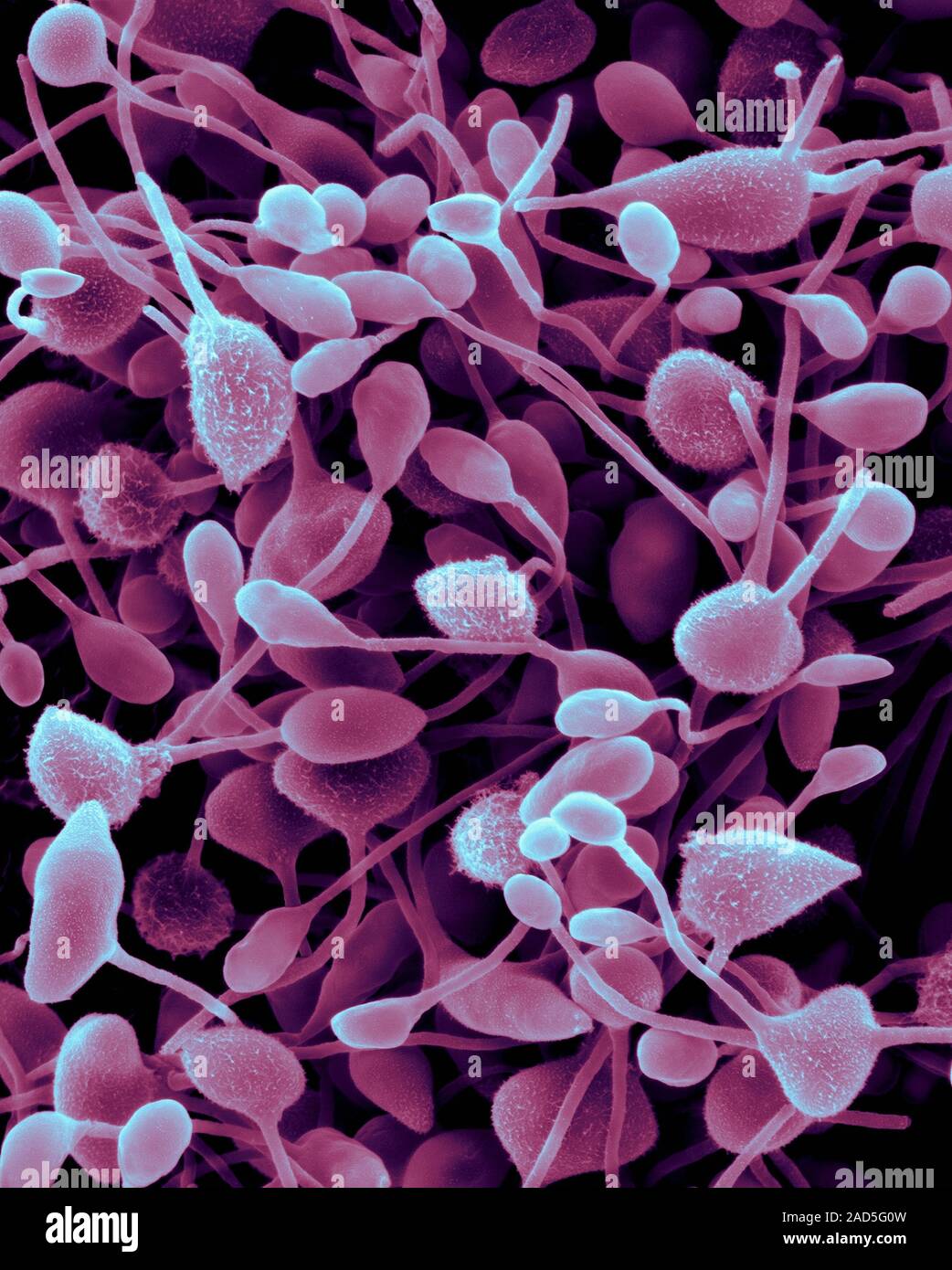 Coloured scanning electron micrograph (SEM) of the basidiomycetous ...