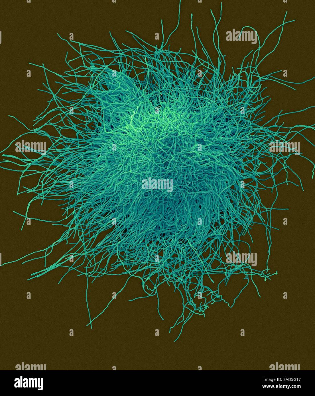 Coloured scanning electron micrograph (SEM) of a fungal colony ...