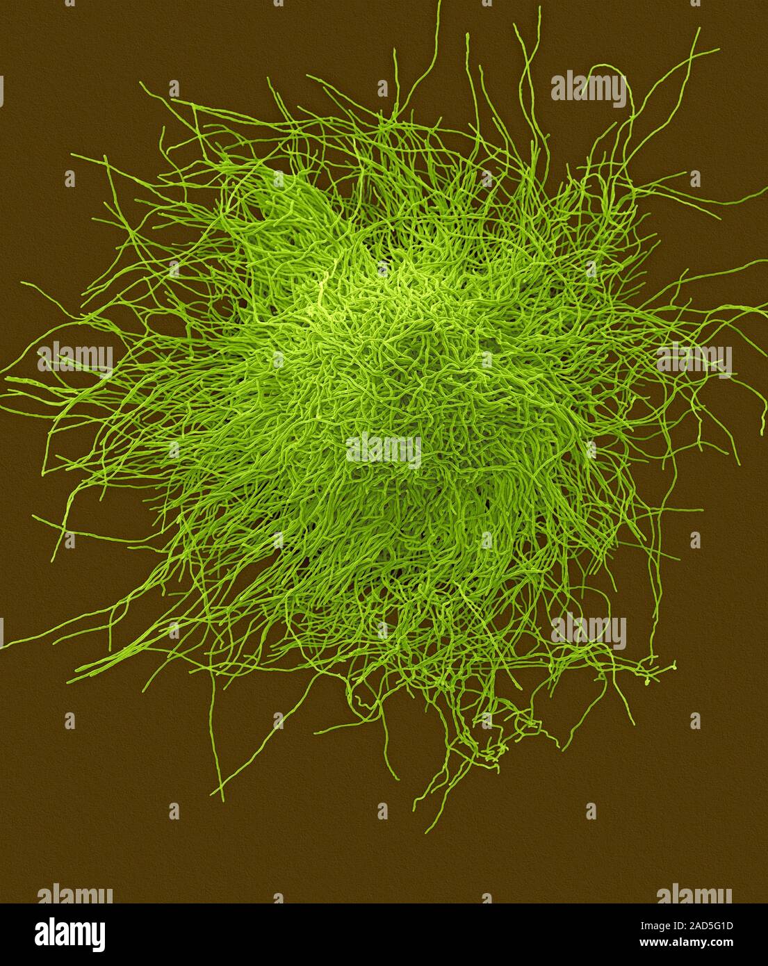 Coloured scanning electron micrograph (SEM) of a fungal colony ...