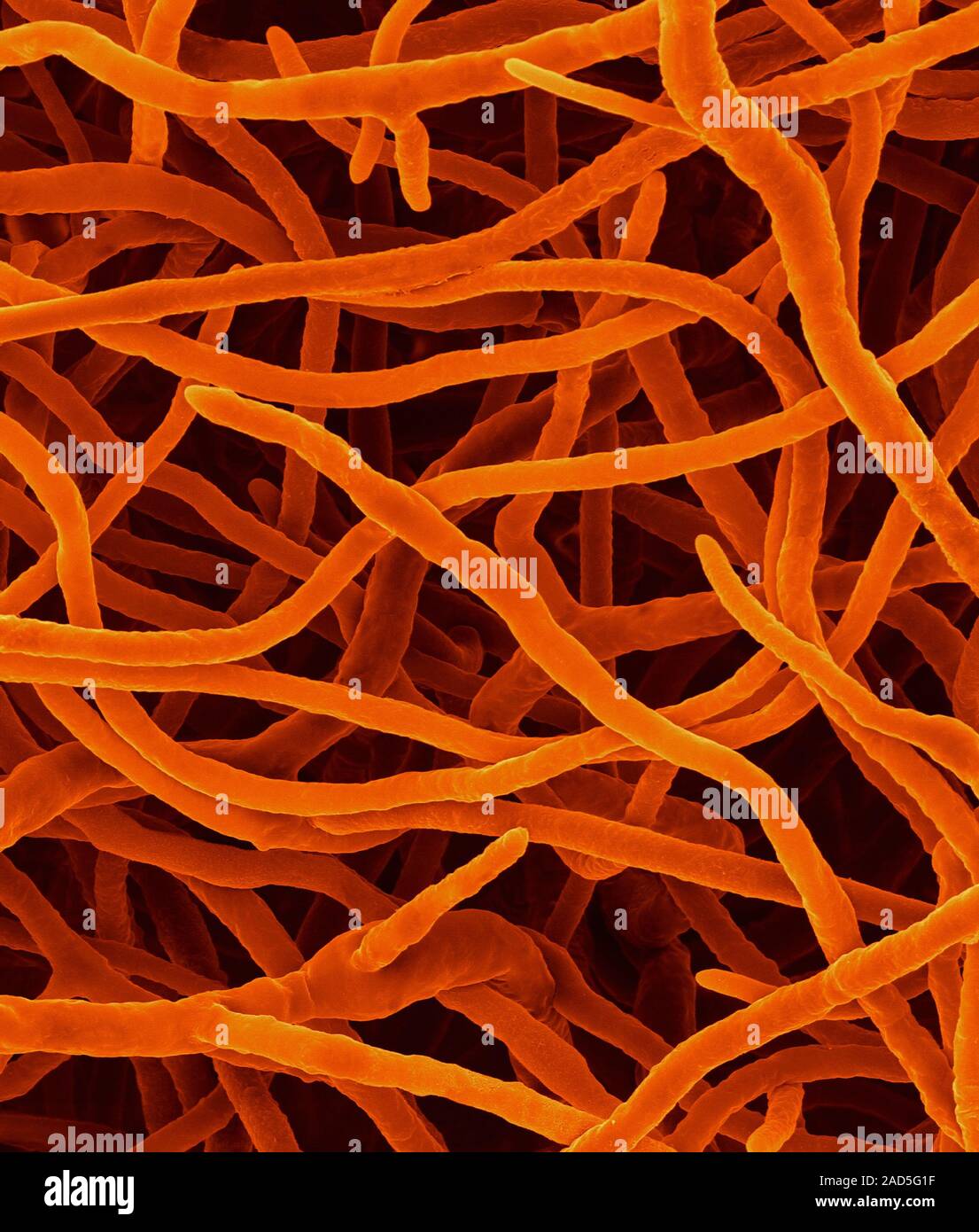 Coloured scanning electron micrograph (SEM) of the branched ...