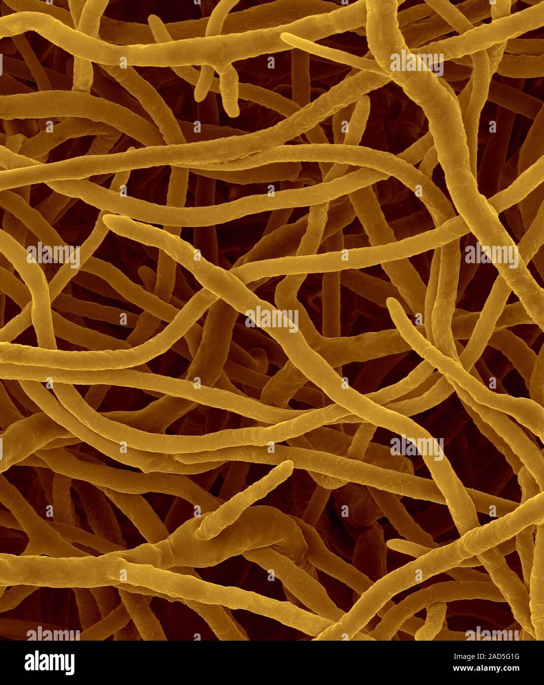 Coloured scanning electron micrograph (SEM) of the branched ...