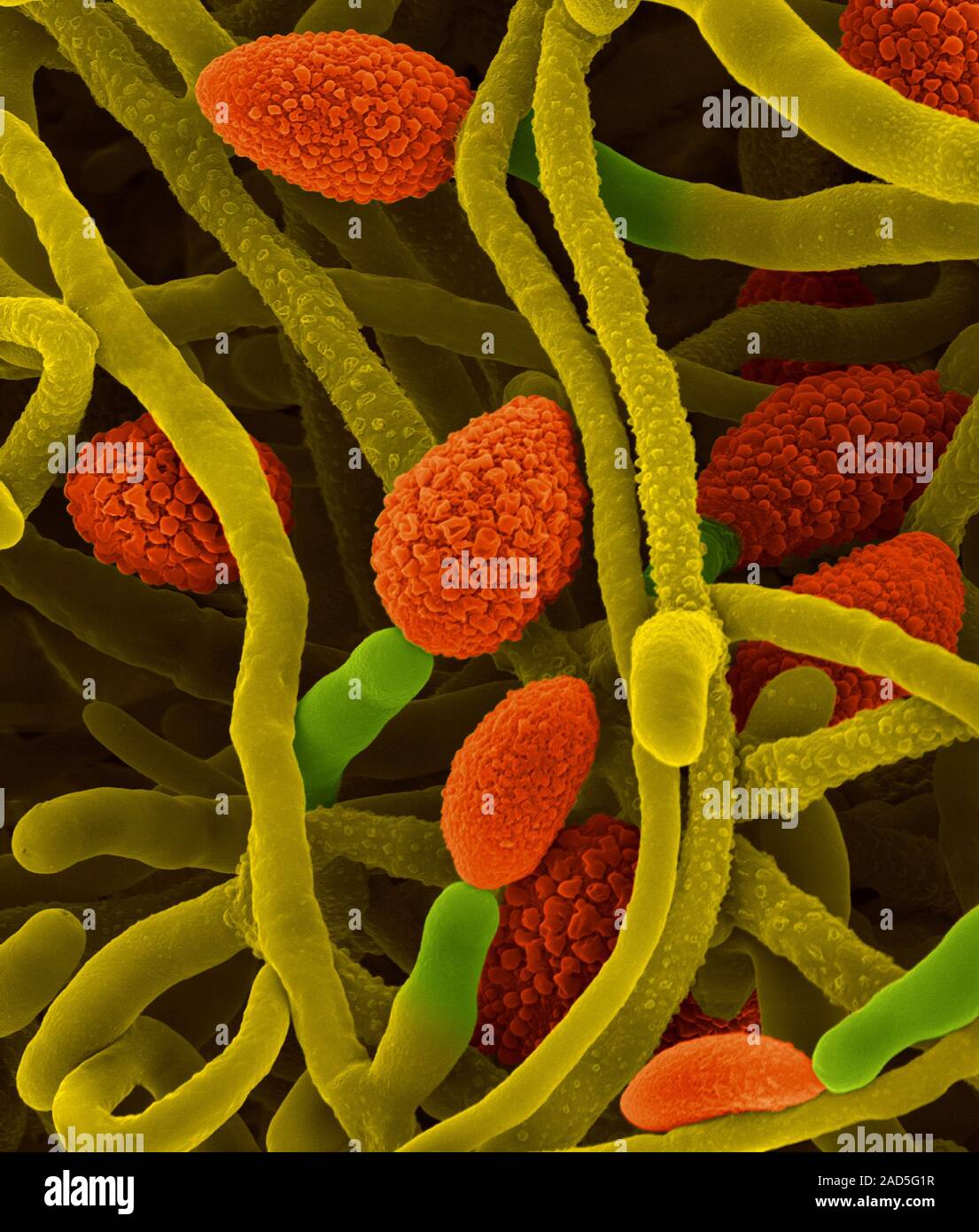 Coloured scanning electron micrograph (SEM) of Sporulating, filamentous ...