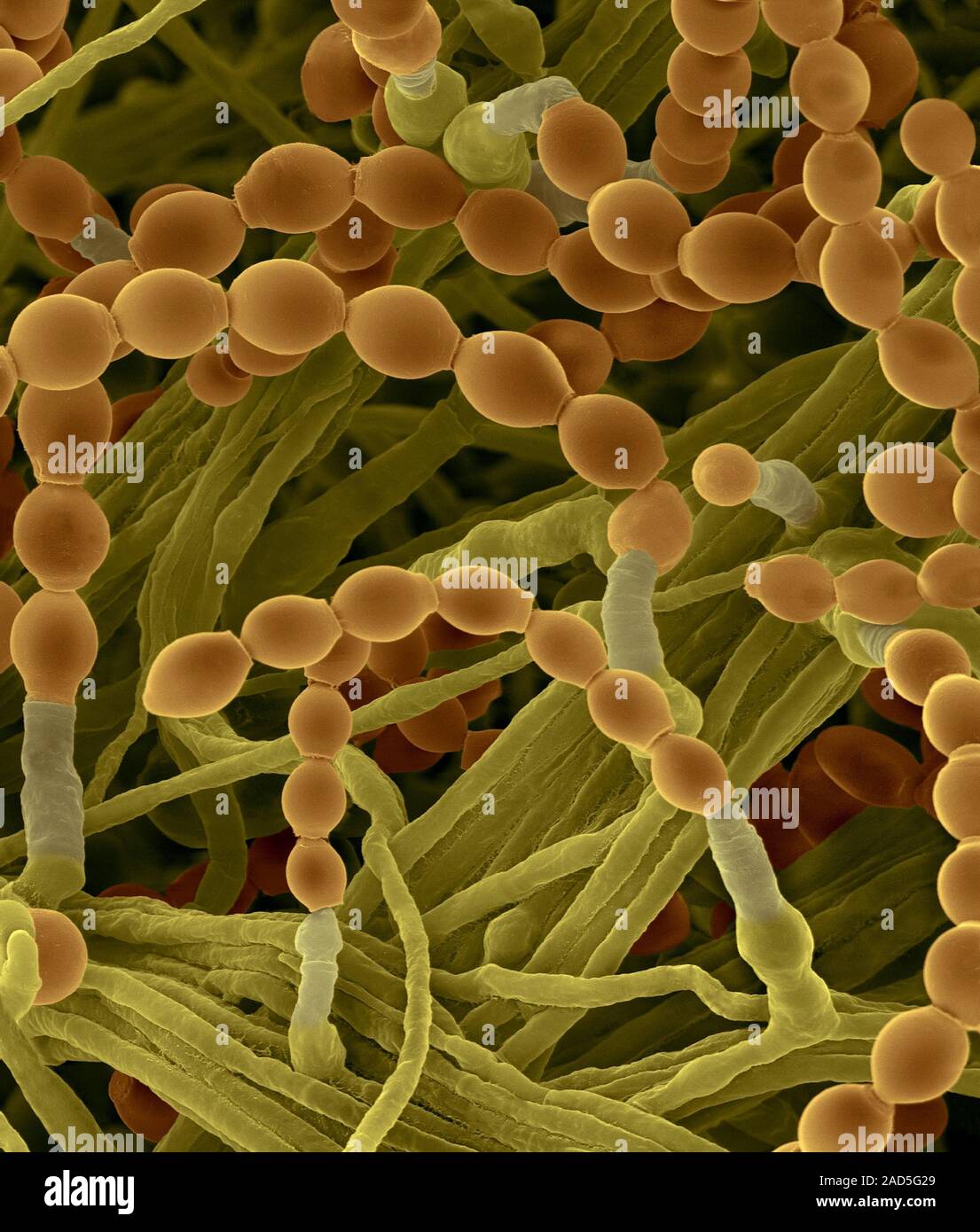 Coloured scanning electron micrograph (SEM) of Hyphae and conidia ...