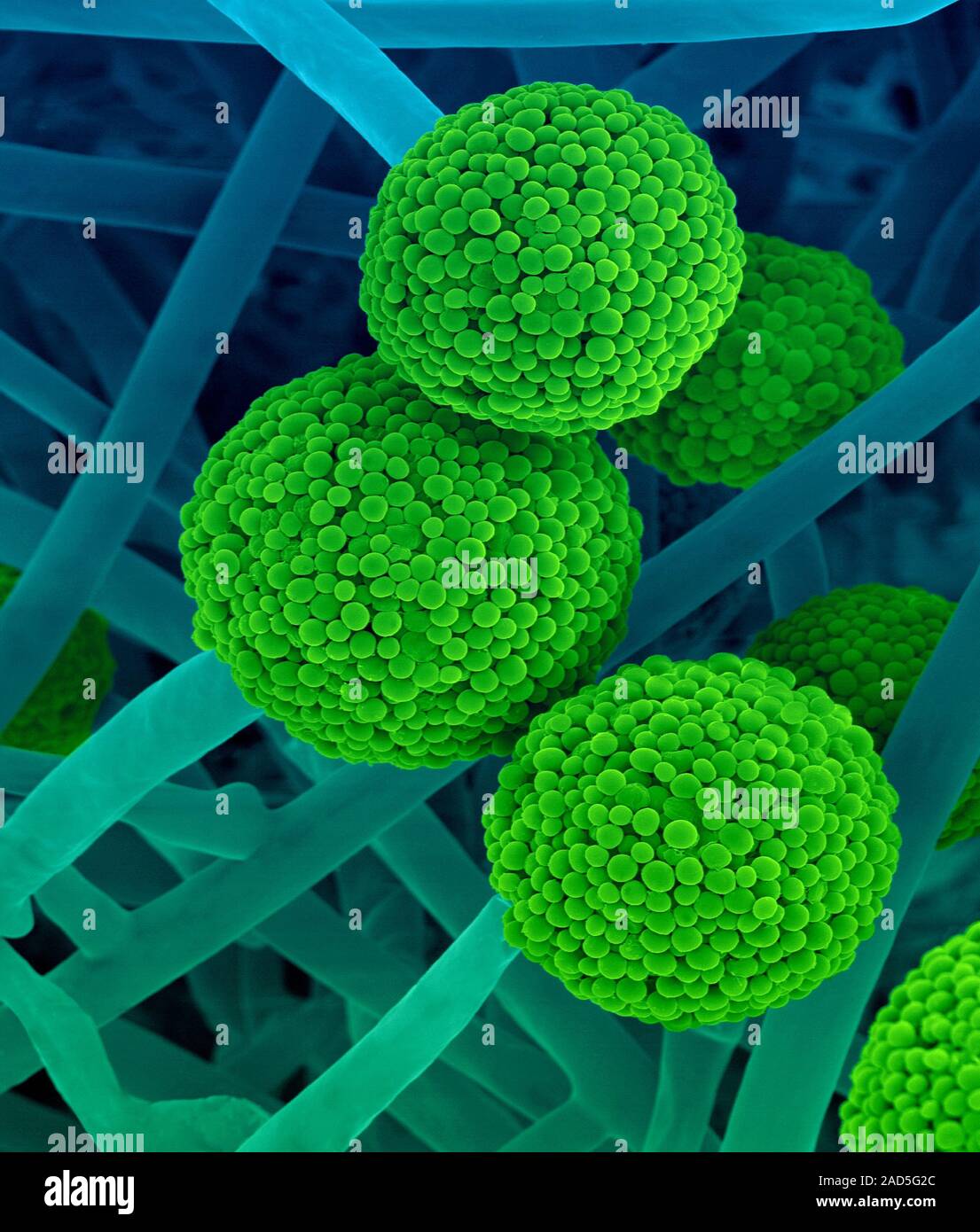 Coloured scanning electron micrograph (SEM) of Thermophilic zygomycete ...