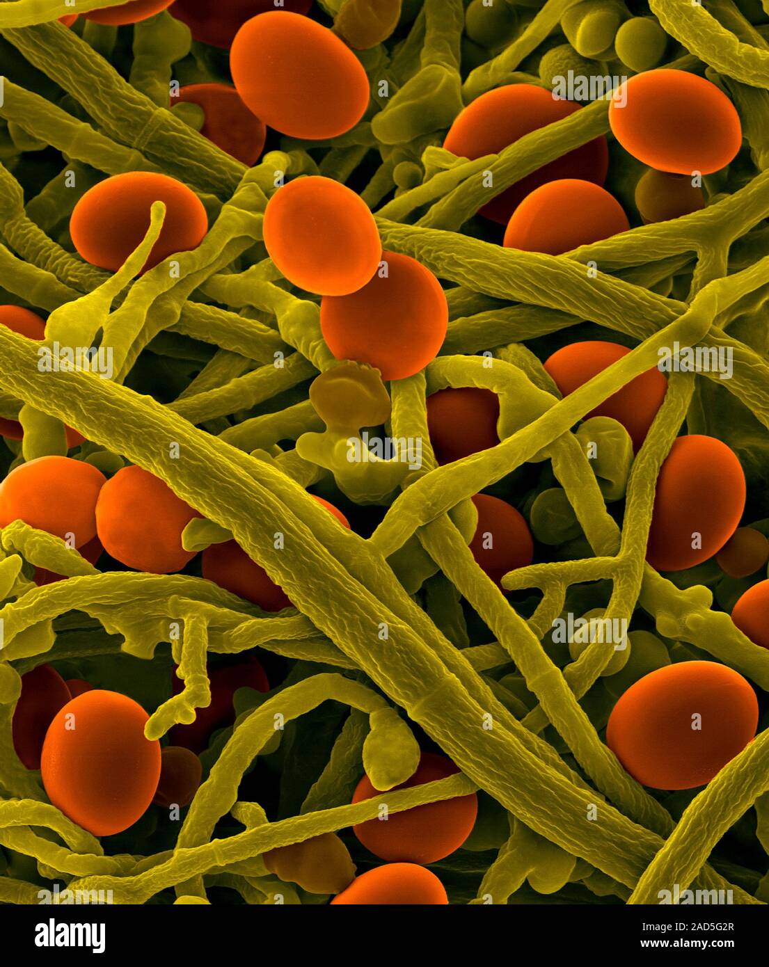 Coloured scanning electron micrograph (SEM) of Sporulating, filamentous ...