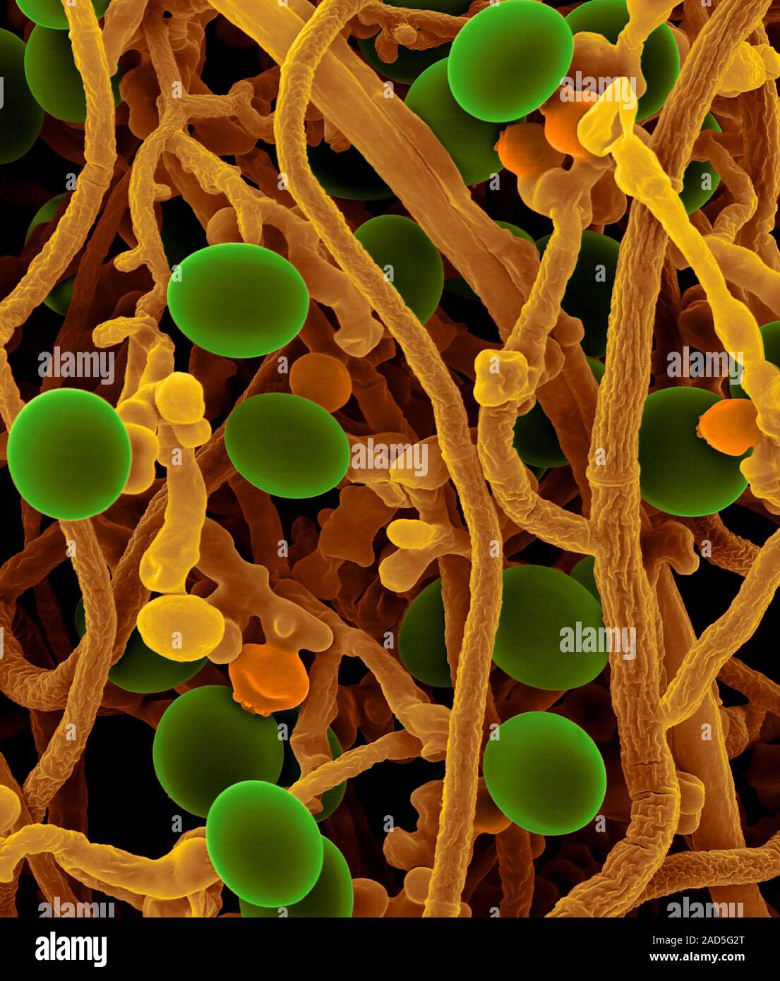 Coloured scanning electron micrograph (SEM) of Sporulating, filamentous ...
