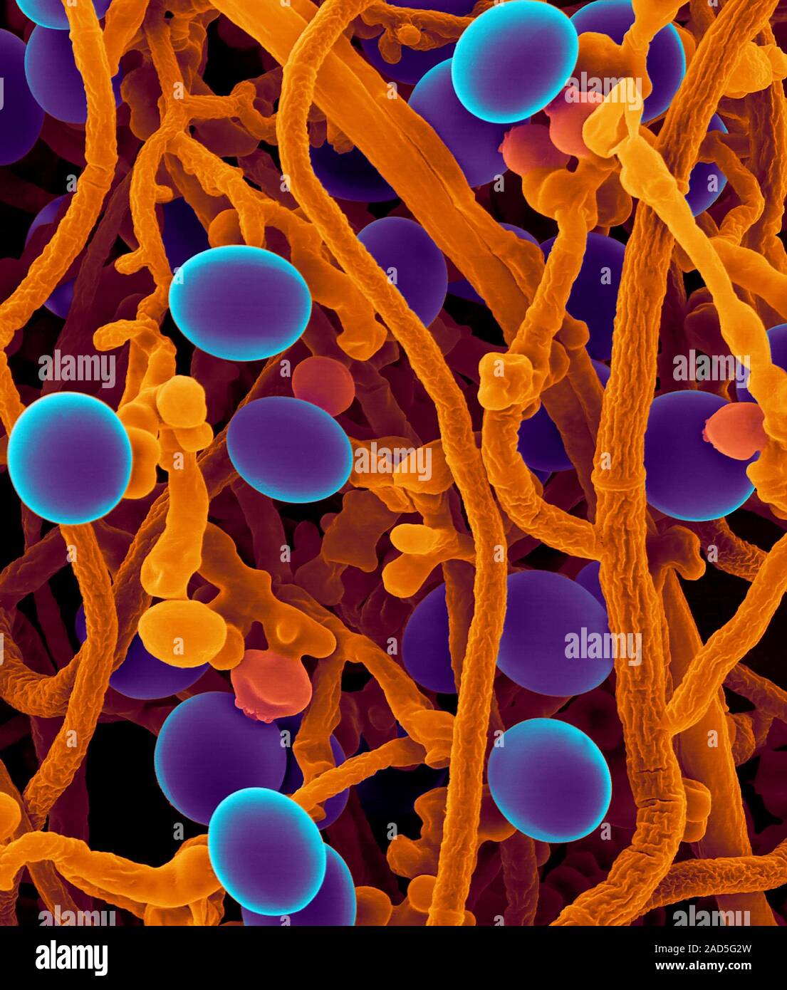 Coloured scanning electron micrograph (SEM) of Sporulating, filamentous ...