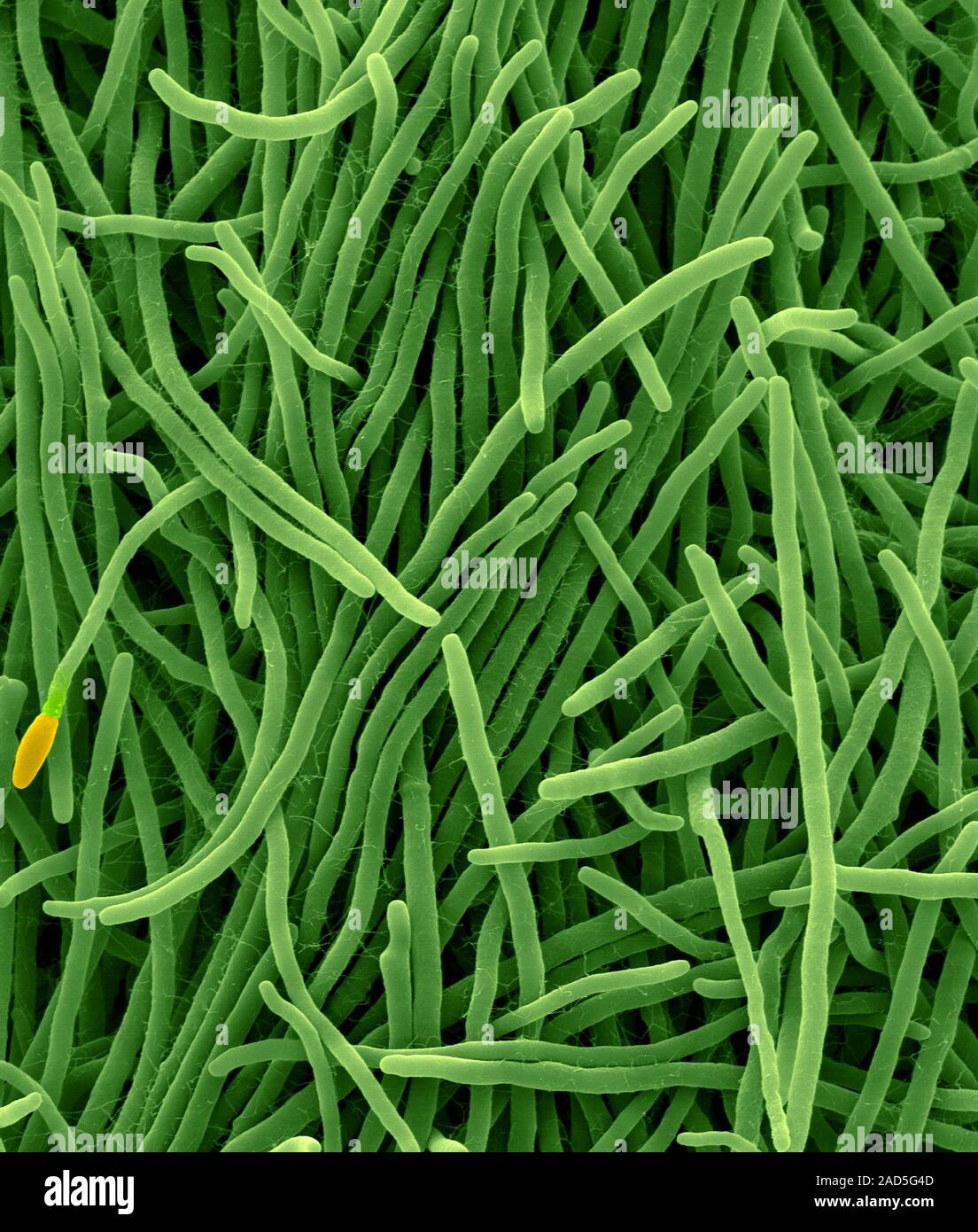 Coloured scanning electron micrograph (SEM) of the common filamentous ...
