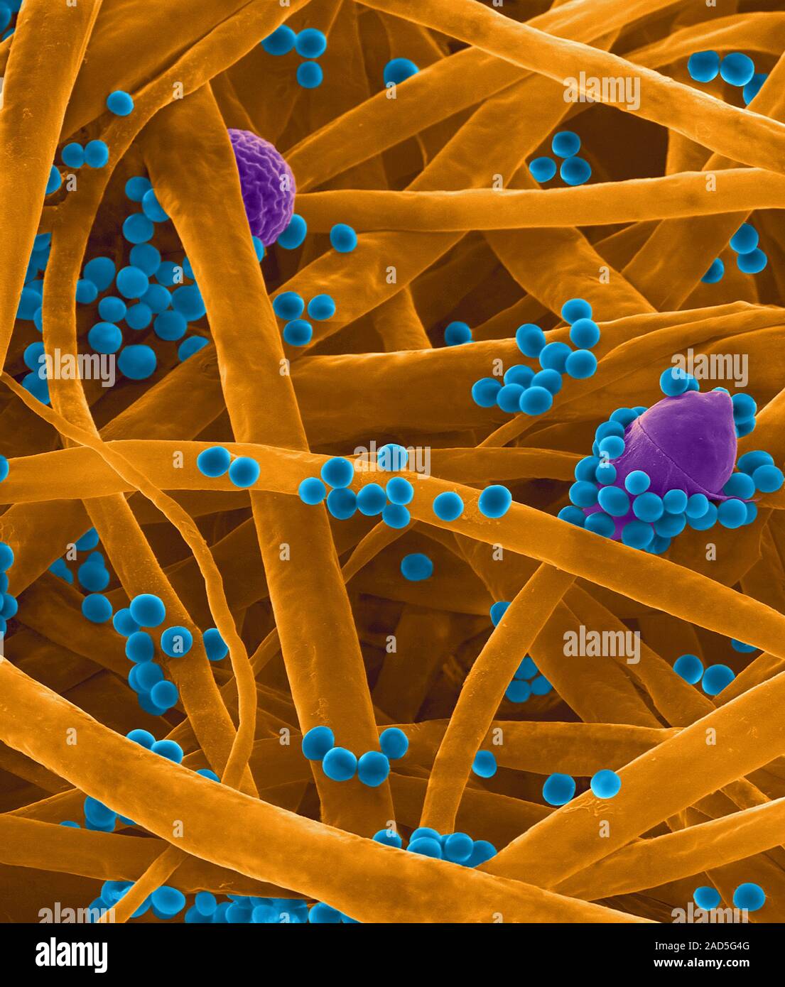 Coloured scanning electron micrograph (SEM) of Hyphae and fruiting ...