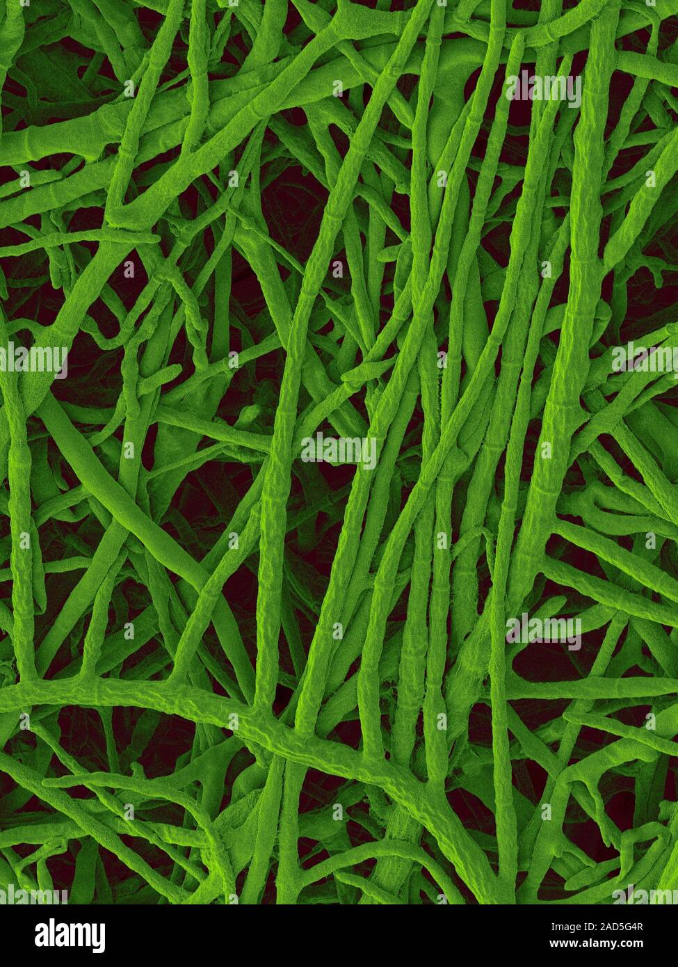Coloured scanning electron micrograph (SEM) of Curvularia verruculosa ...