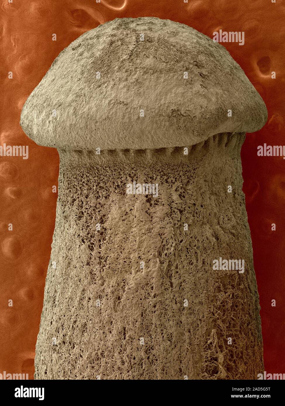 Coloured scanning electron micrograph (SEM) of Mycorrhizal fungus ...
