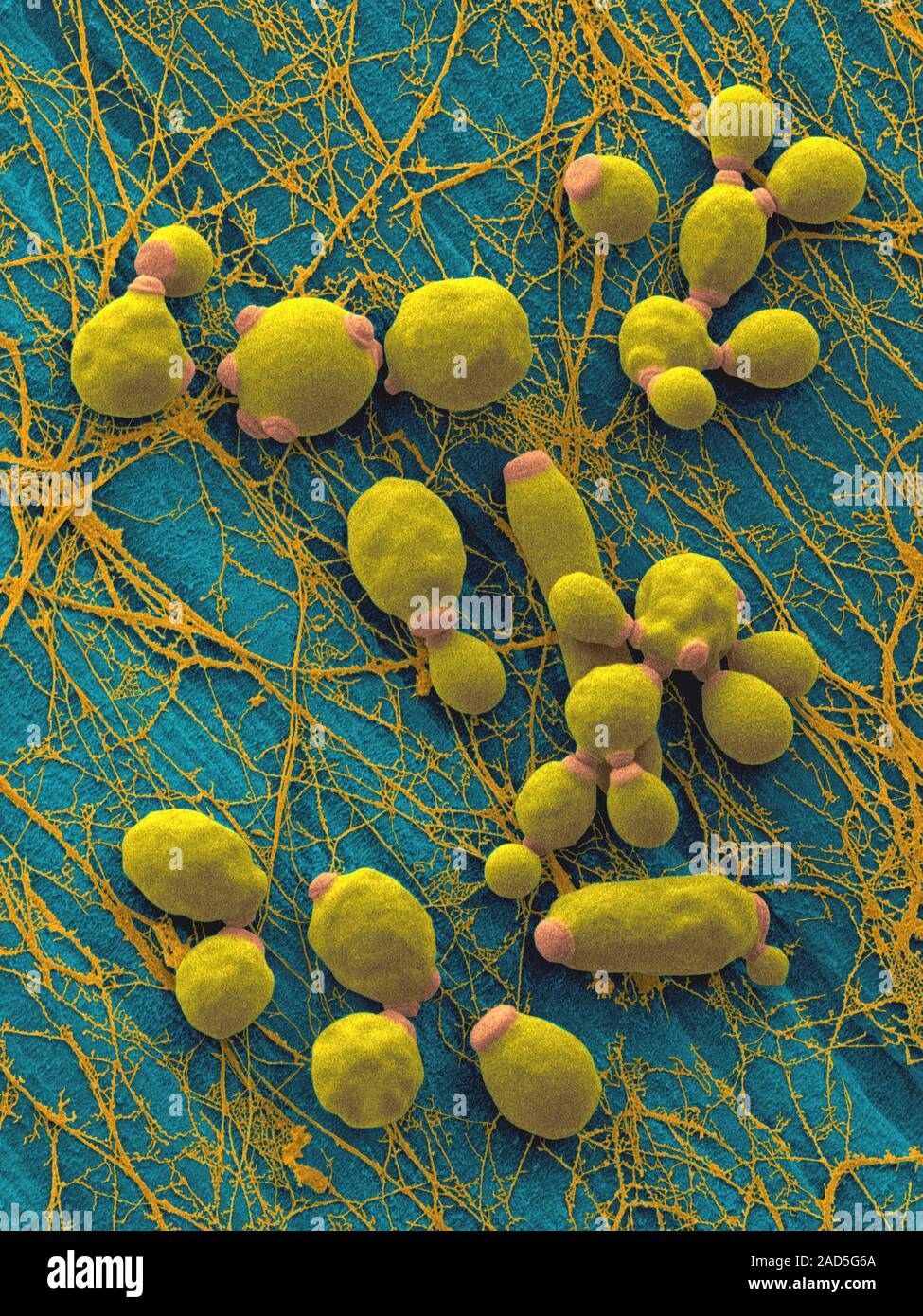 Coloured scanning electron micrograph (SEM) of Candida albicans ...