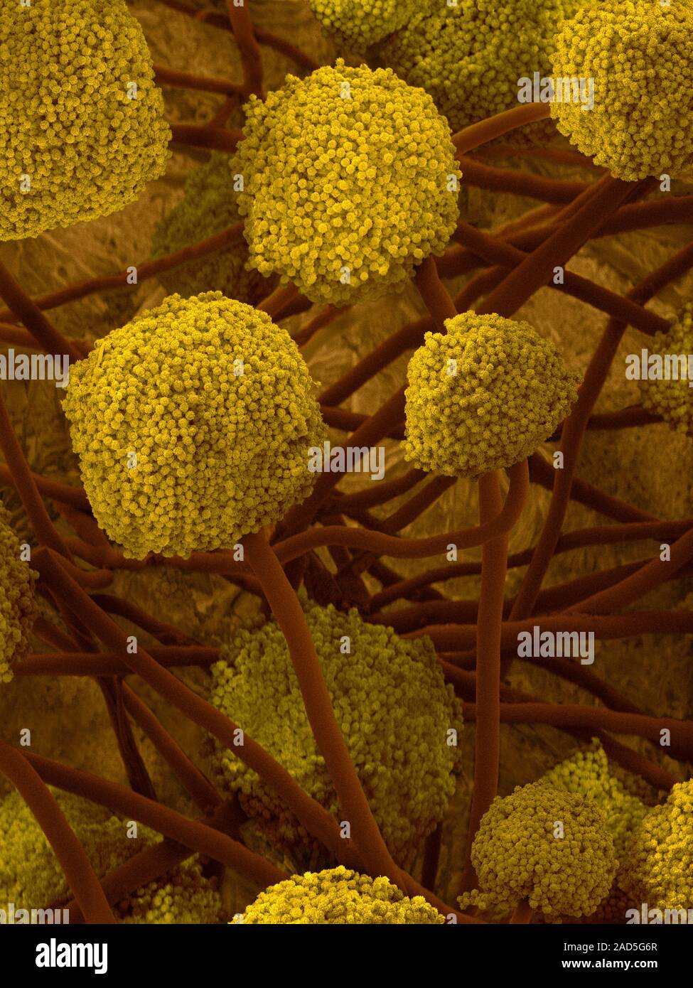 Coloured scanning electron micrograph (SEM) of the black mould (Aspergillus brasiliensis ...