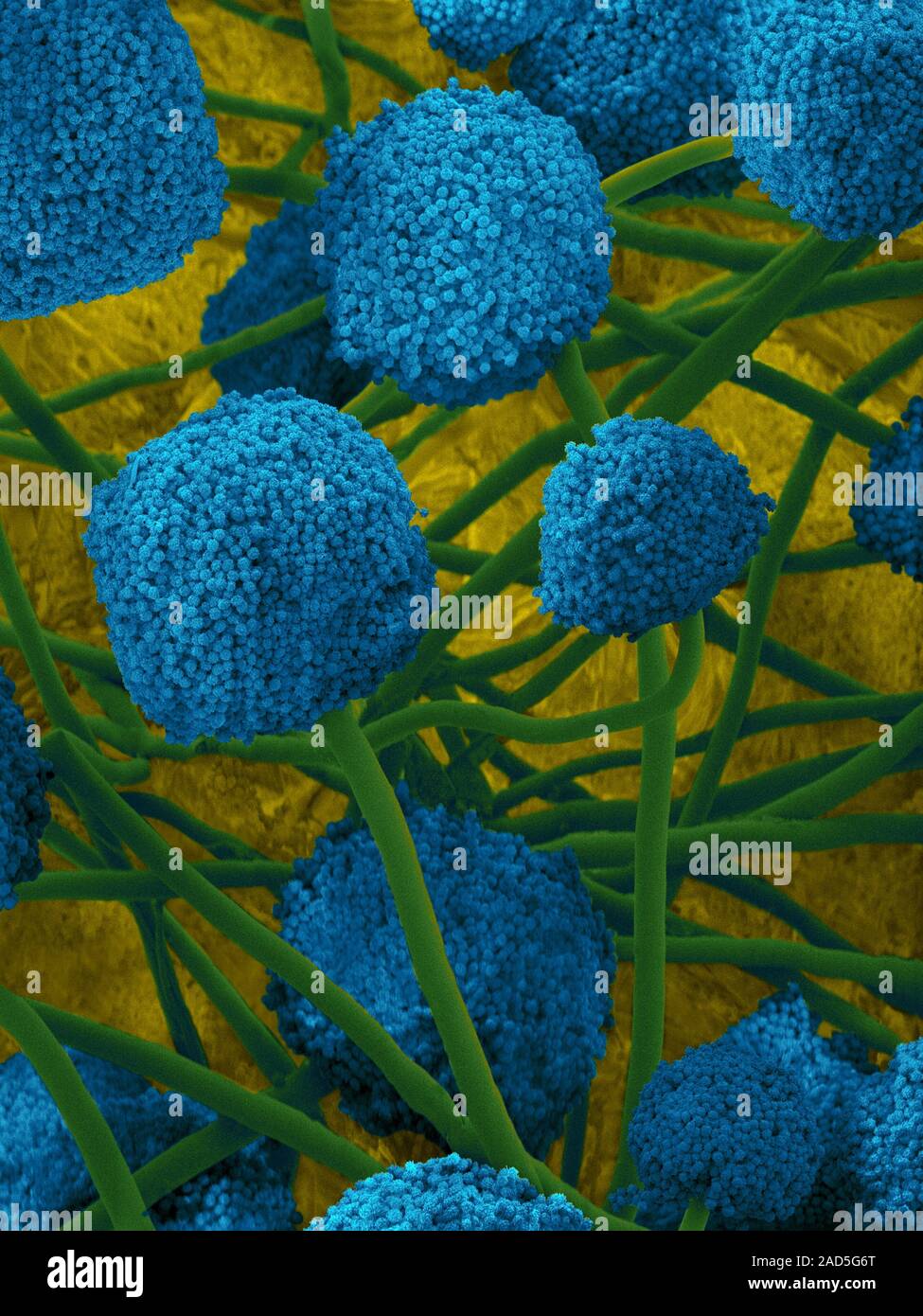 Coloured scanning electron micrograph (SEM) of the black mould (Aspergillus brasiliensis ...