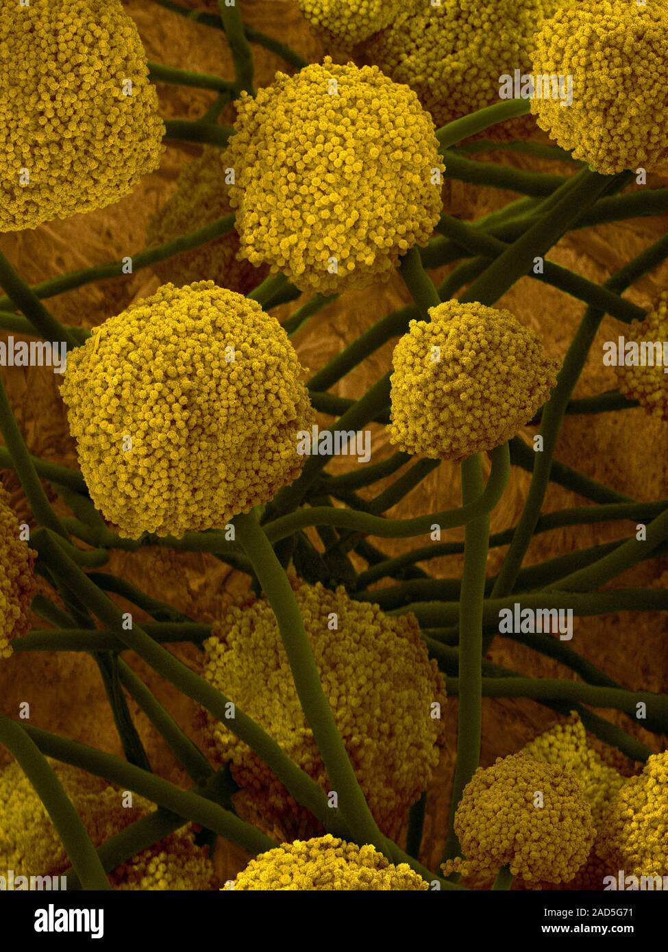 Coloured scanning electron micrograph (SEM) of the black mould ...