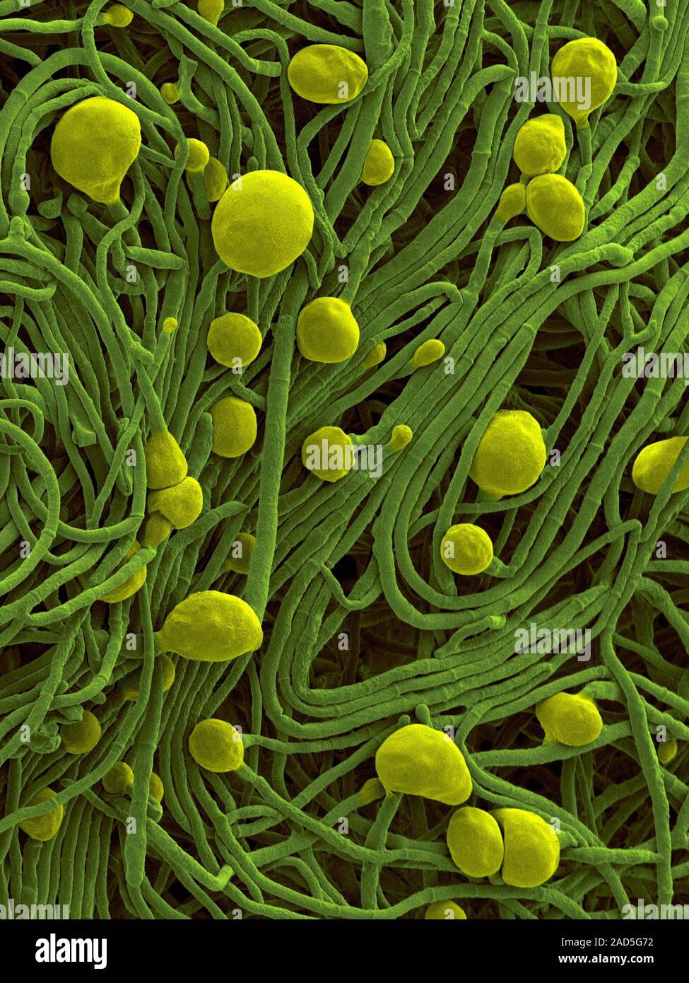 Coloured scanning electron micrograph (SEM) of Periconia cookei ...