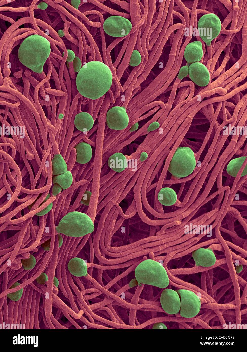 Coloured scanning electron micrograph (SEM) of Periconia cookei ...