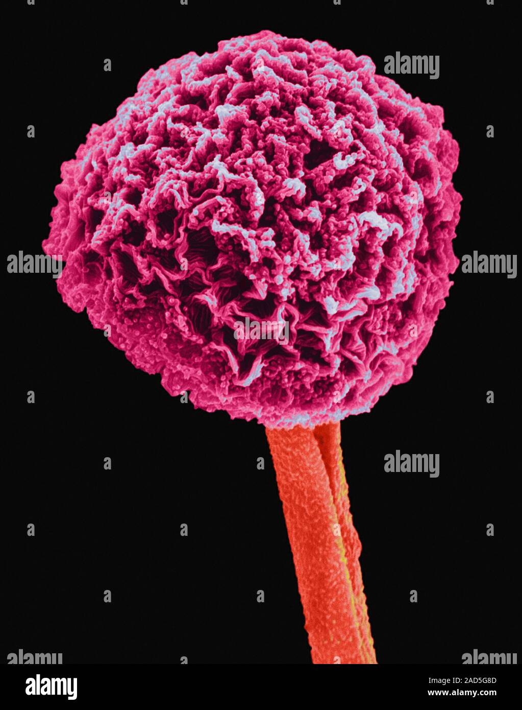 Coloured scanning electron micrograph (SEM) of Fruiting structure (sporangium) of the common ...