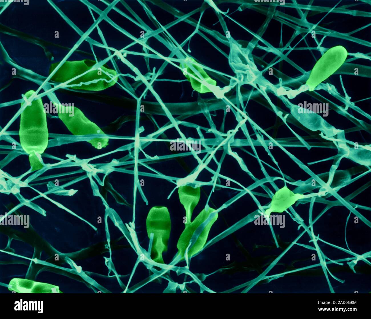 Coloured scanning electron micrograph (SEM) of Athlete's foot fungus ...
