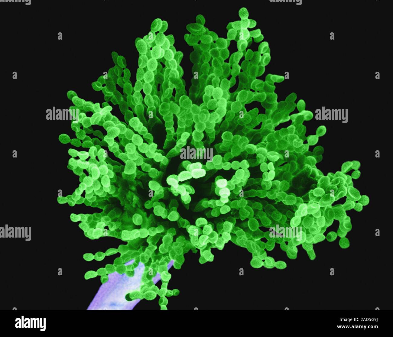 Coloured scanning electron micrograph (SEM) of Aspergillus sp. mould. The conidiophore (fruiting ...
