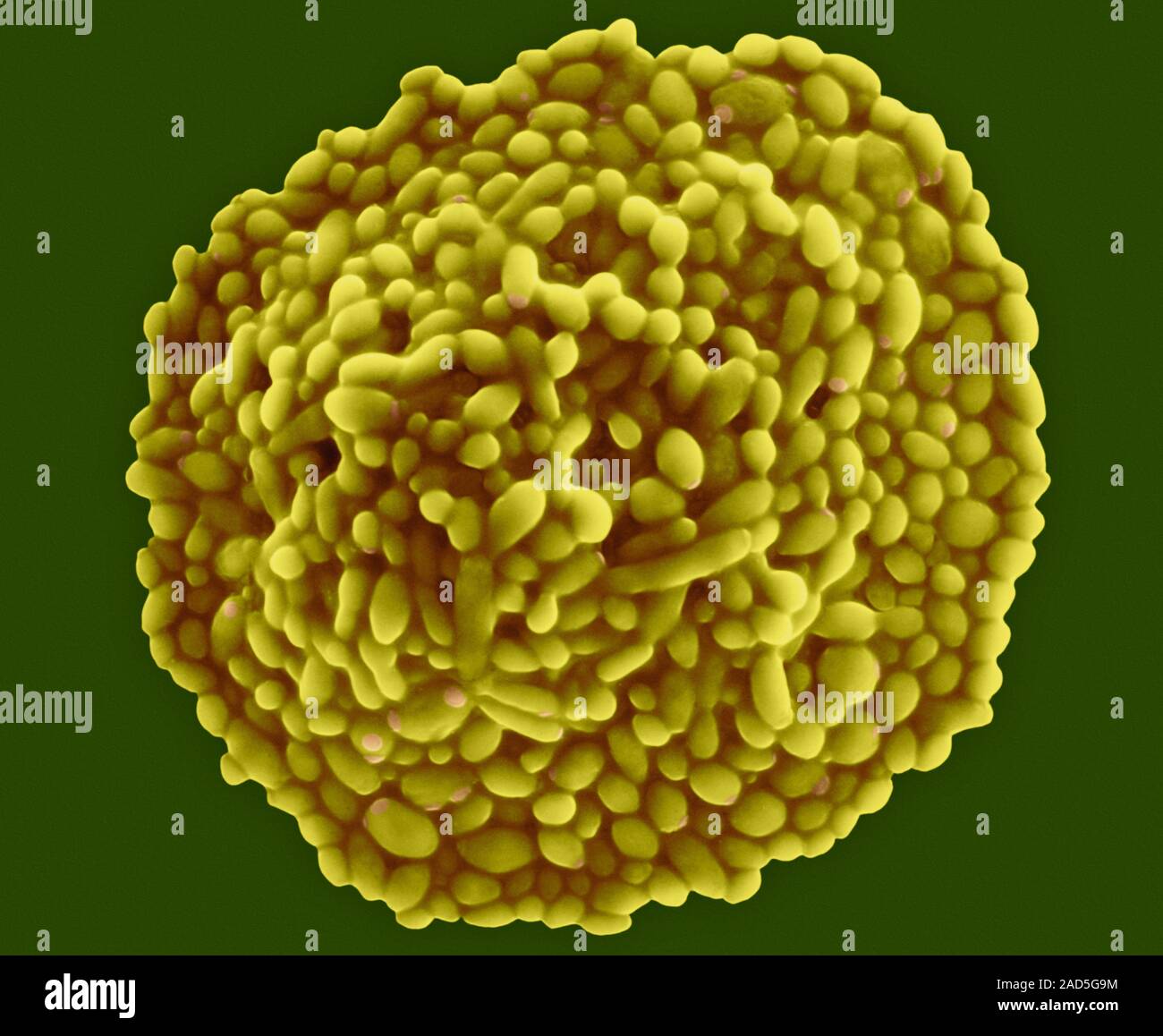 Coloured scanning electron micrograph (SEM) of Yeast Colony ...