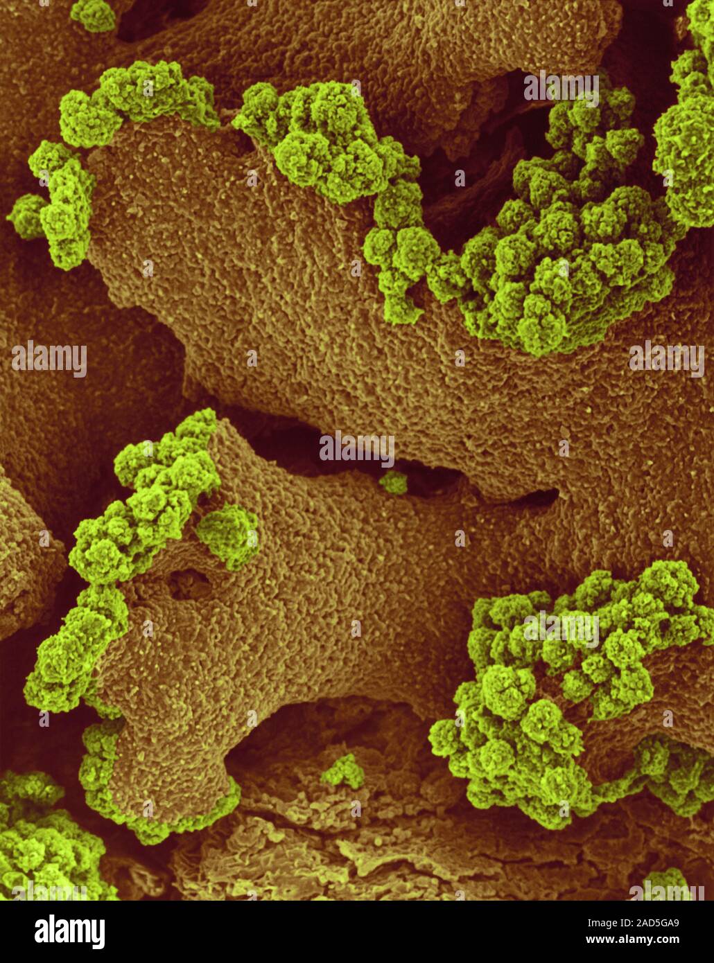 Coloured scanning electron micrograph (SEM) of Thallus surface of the ...