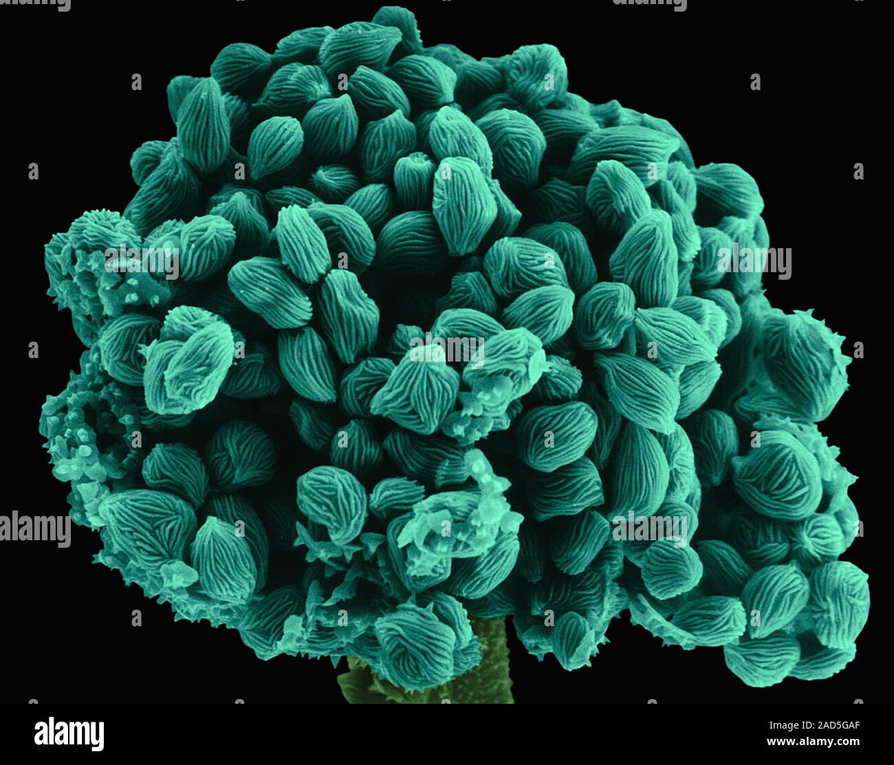 Coloured scanning electron micrograph (SEM) of Fruiting structure (sporangia) of the common ...