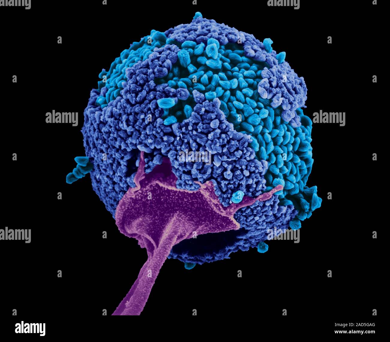 Coloured scanning electron micrograph (SEM) of Fruiting structure ...