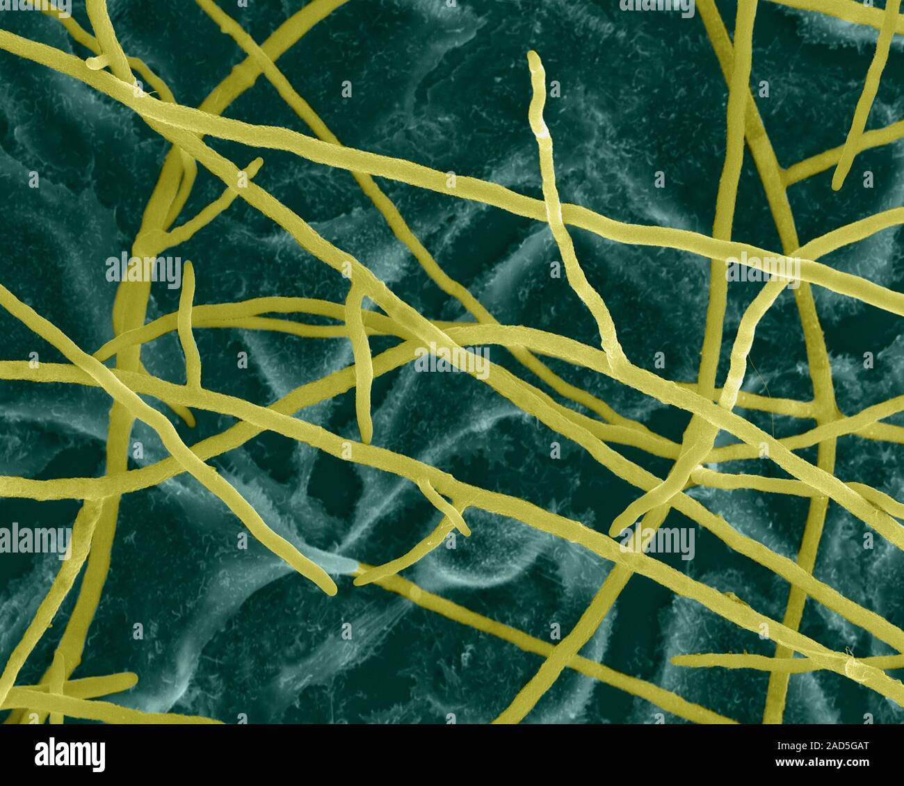 Coloured scanning electron micrograph (SEM) of Fungal hyphae from an ...