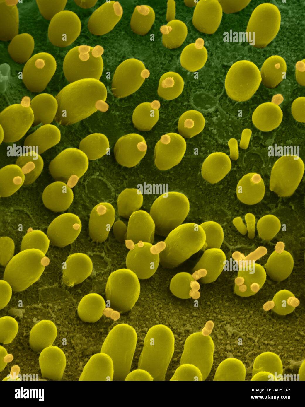 Coloured scanning electron micrograph (SEM) of the budding yeast on the ...