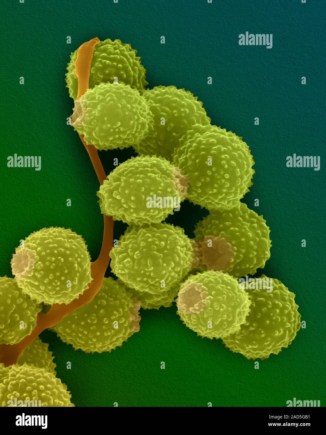 Coloured scanning electron micrograph (SEM) of Powdery mildew mould ...