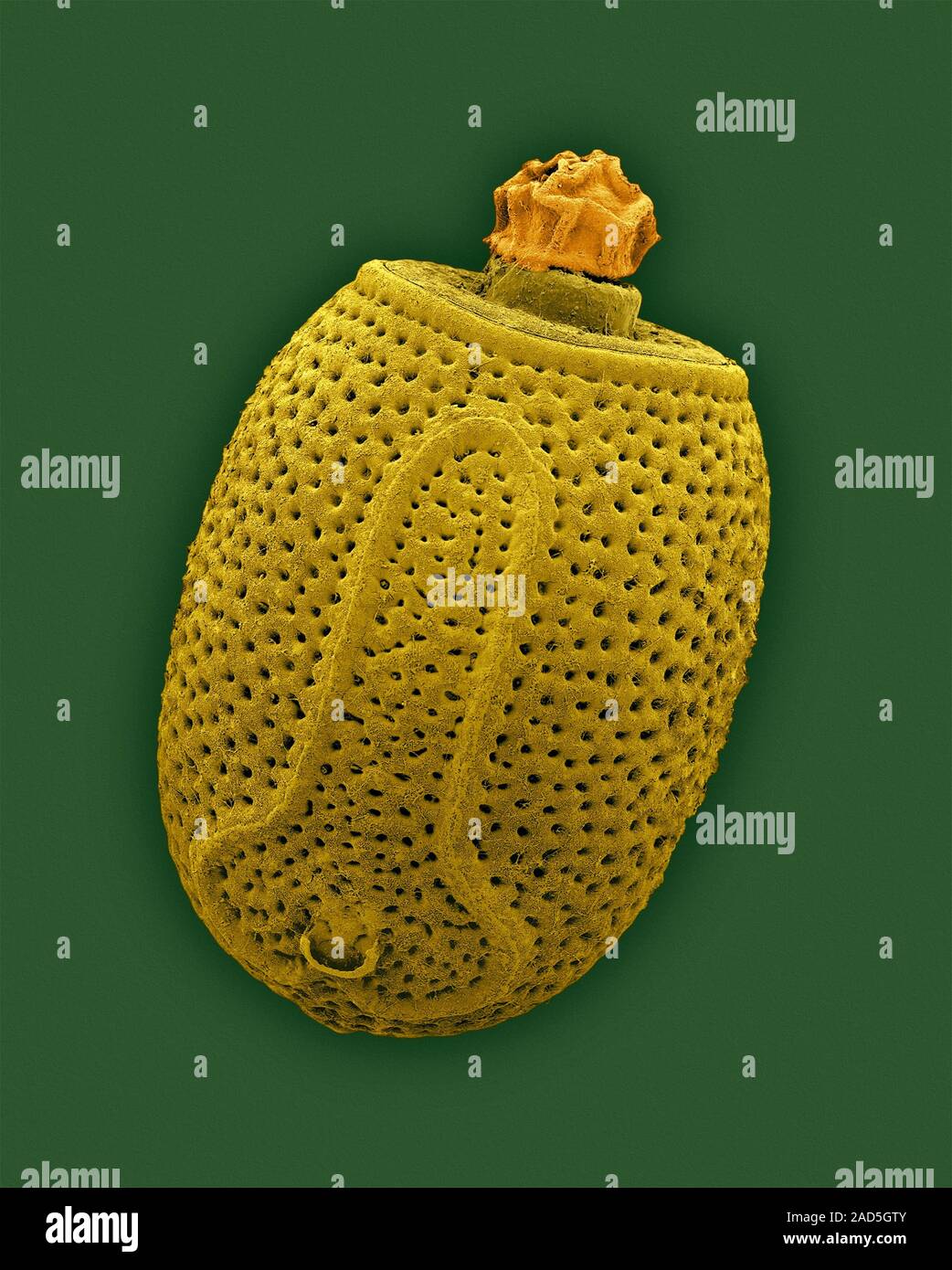 Coloured scanning electron micrograph (SEM) of Walking stick egg case ...