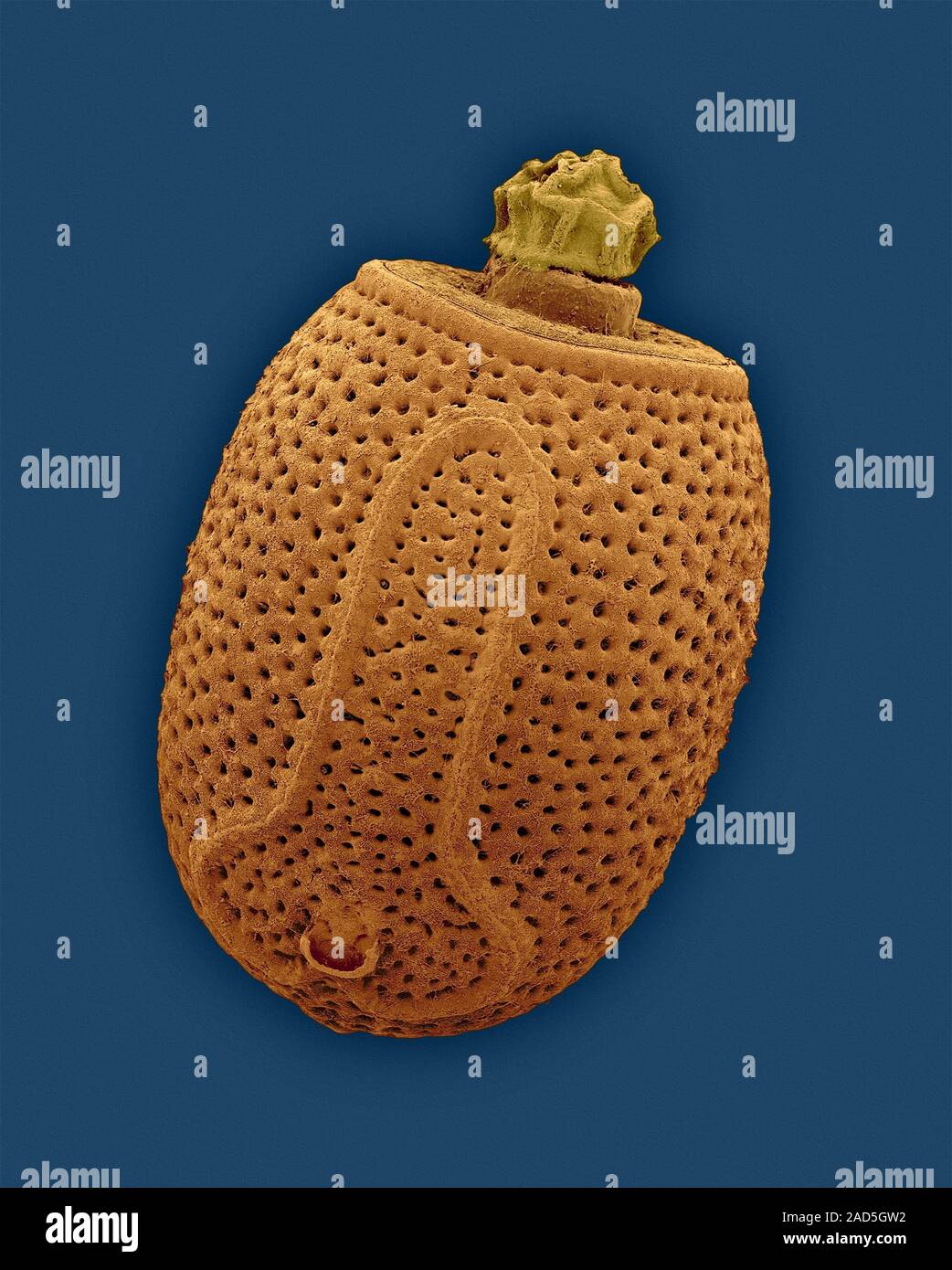 Coloured scanning electron micrograph (SEM) of Walking stick egg case ...