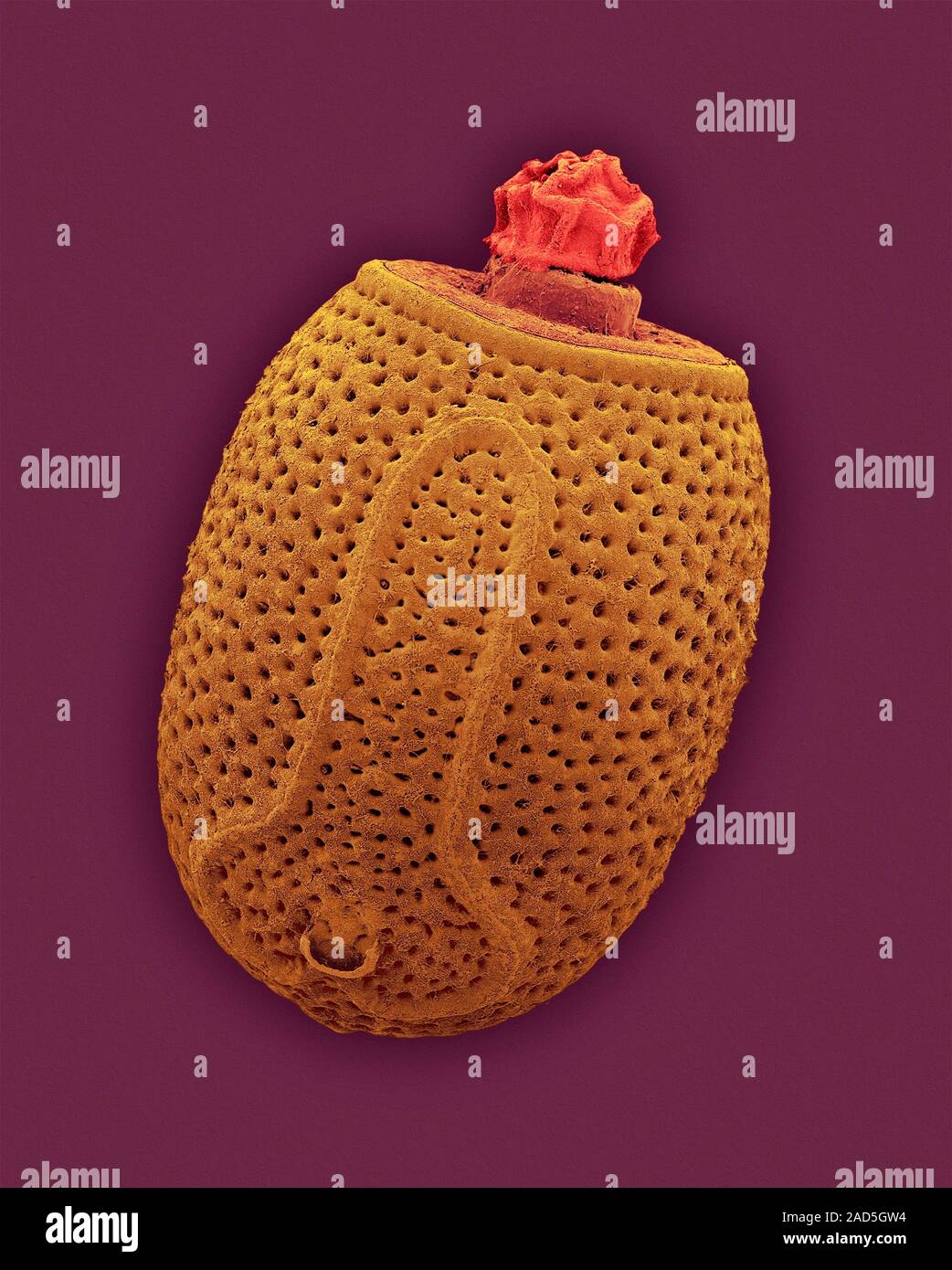 Coloured scanning electron micrograph (SEM) of Walking stick egg case ...