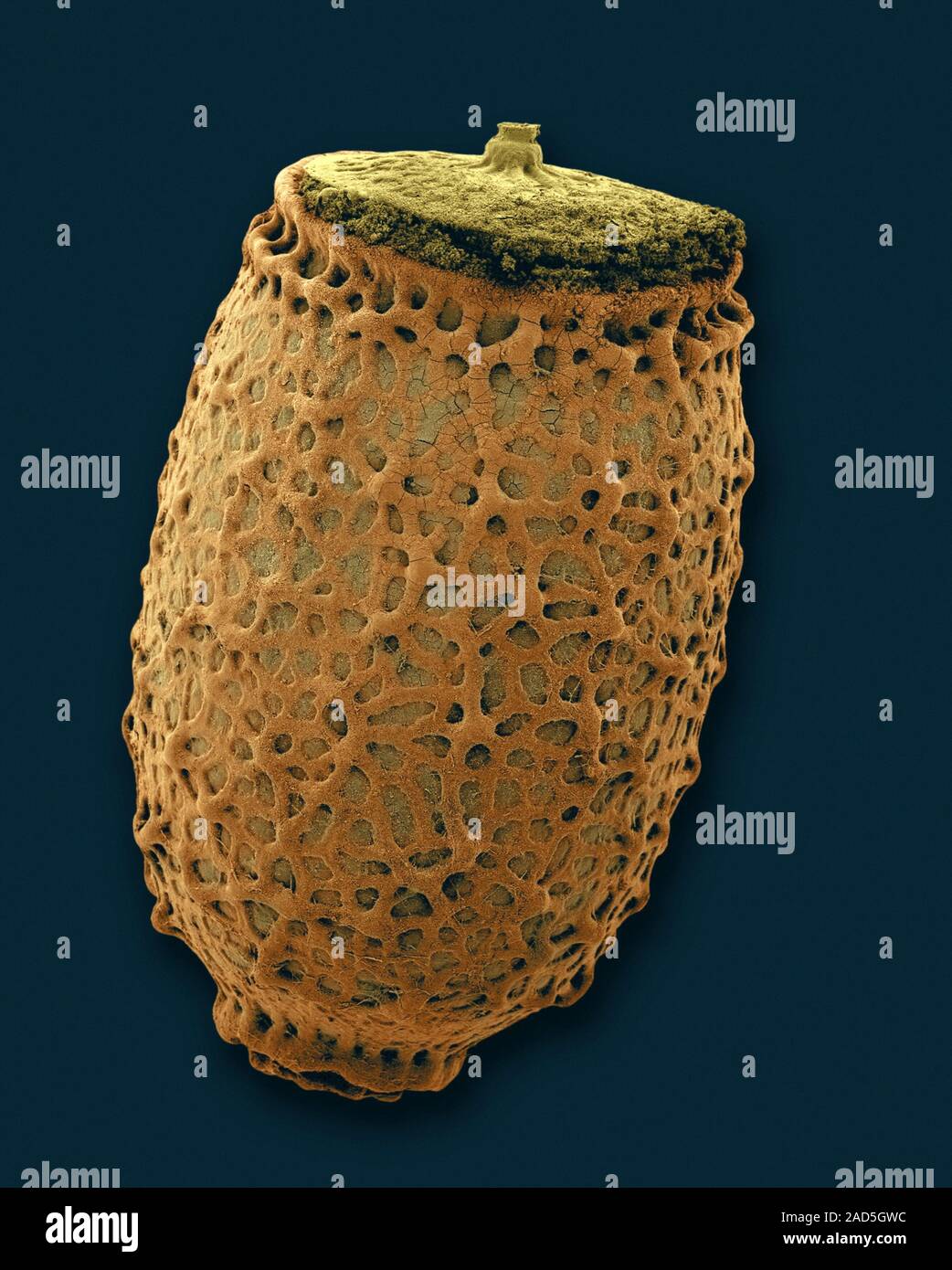 Coloured scanning electron micrograph (SEM) of Walking stick egg case ...
