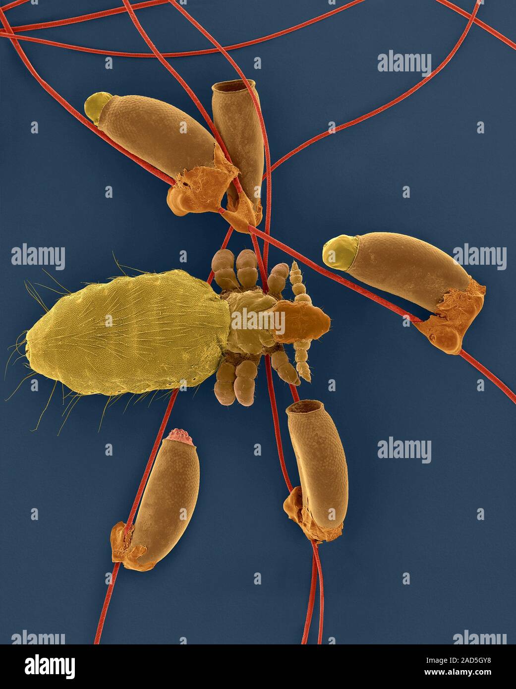 Coloured scanning electron micrograph (SEM) of Long-nosed cattle louse ...